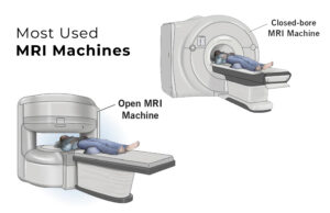Different Types of MRI Scans: A Comprehensive Overview